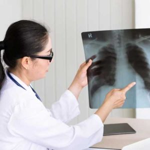 Peran Dokter Anak Ahli Respirologi (Gangguan Pernapasan & Penyakit Paru)