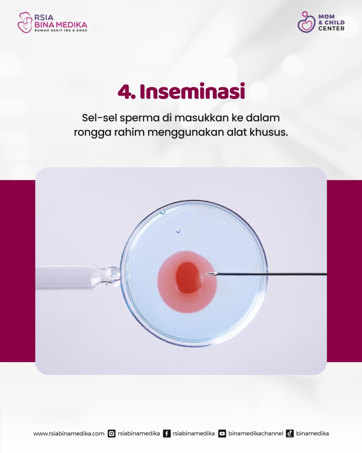 Ketahui Tahapan Proses Inseminasi dan Biayanya