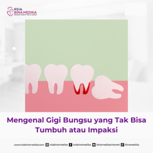 Mengenal Gigi Bungsu yang Tak Bisa Tumbuh atau Impaksi - RSIA BINAMEDIKA