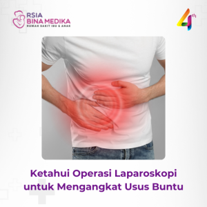 Ketahui Operasi Laparoskopi untuk Mengangkat Usus Buntu - RSIA BINAMEDIKA